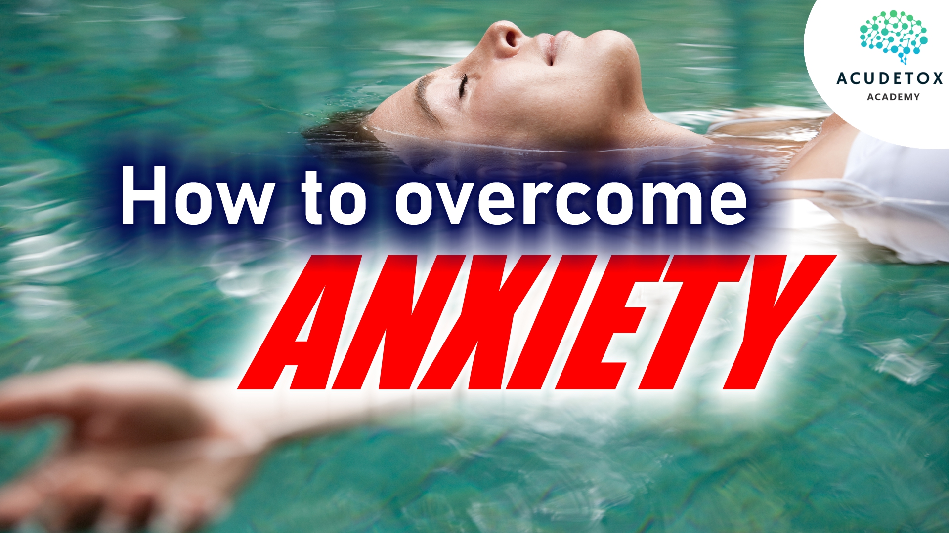 How To Overcome Anxiety, And Live! – Acudetox Academy Online